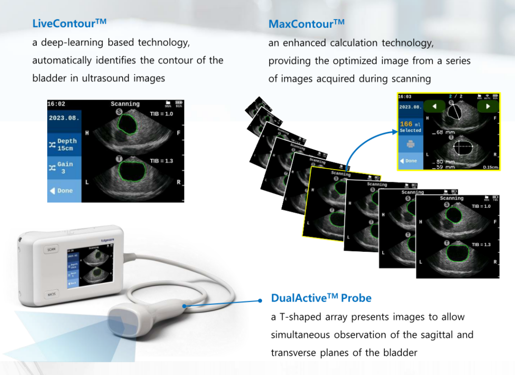 Edgecare Portable Bladder Scanner - Emech Medical New Zealand